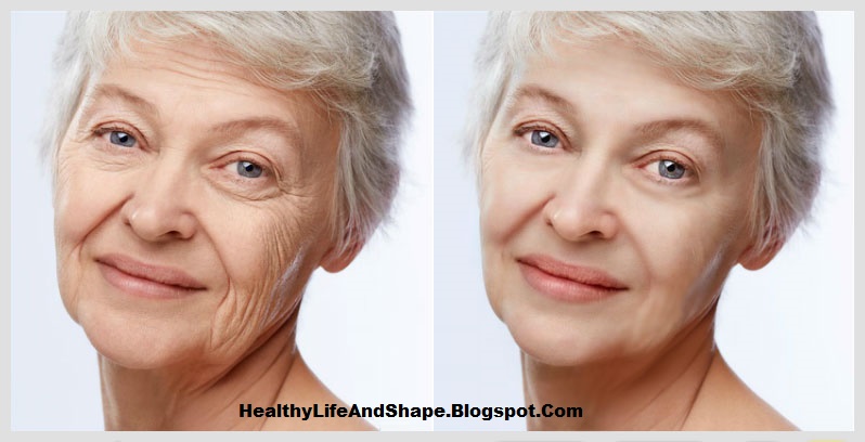 Remove Wrinkle On Face { Best Anti-Aging Secrets } - Healthy Life and Shape