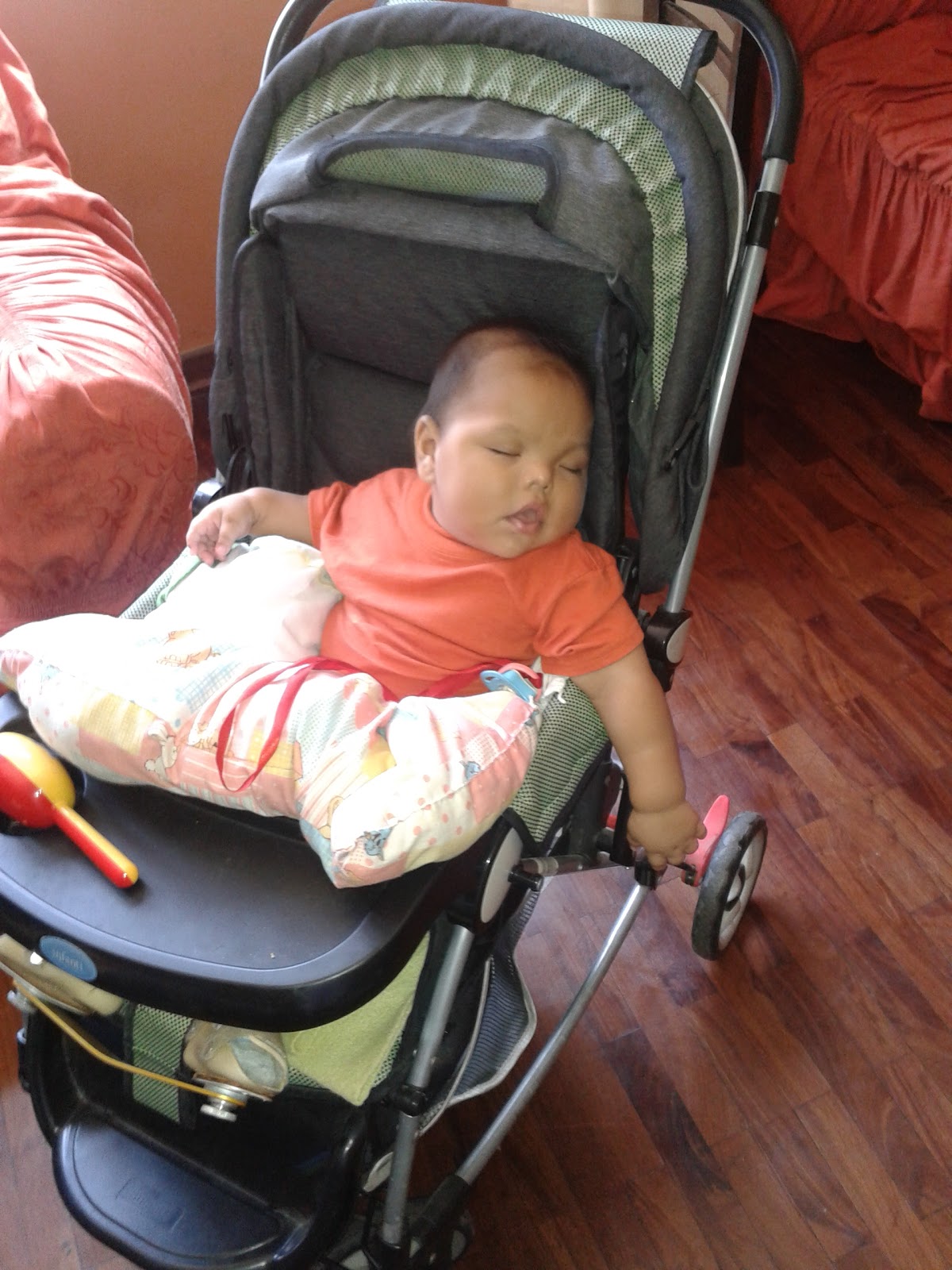 Pie Equino Varo - Pie Bot - Perú: Albúm Fotos Guillermo