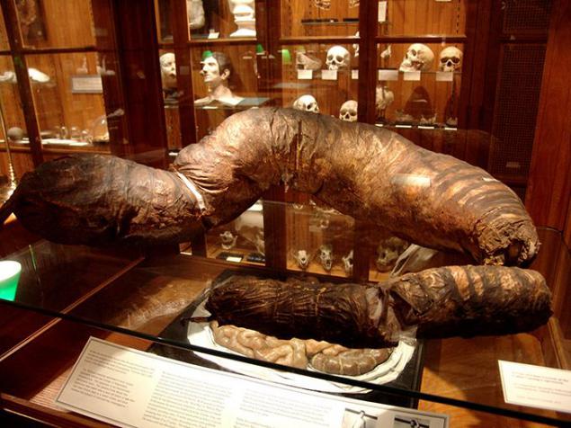 4 Koleksi mengagetkan di Museum Mutter, salah satunya otak Einstein ...