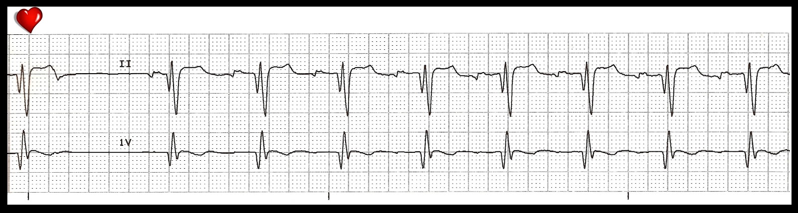 Practice EKG Strips