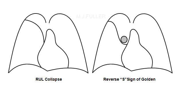 Nos.: Golden S sign.