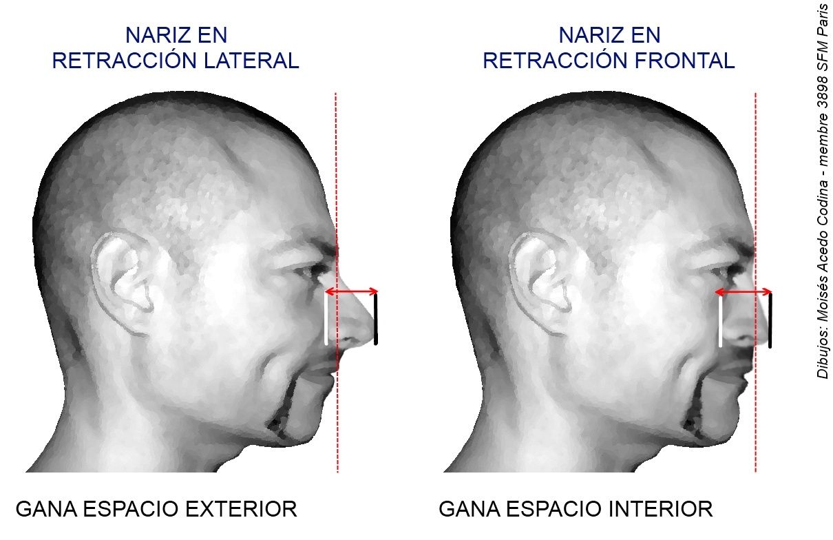 Moisés Acedo Codina: EL RECEPTOR EMOCIONAL: LA NARIZ