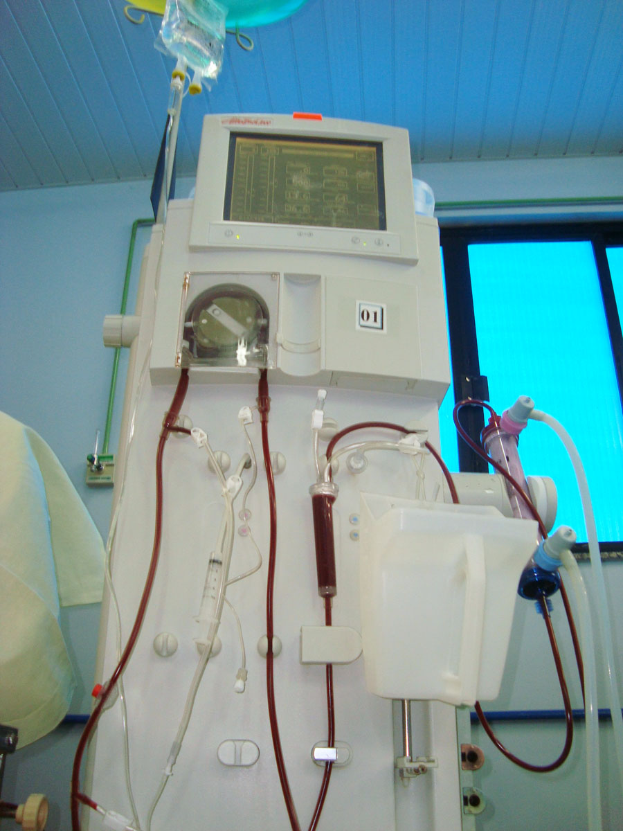 EU E A HEMODIALISE: INTRODUÇÃO - O que é a Hemodiálise?