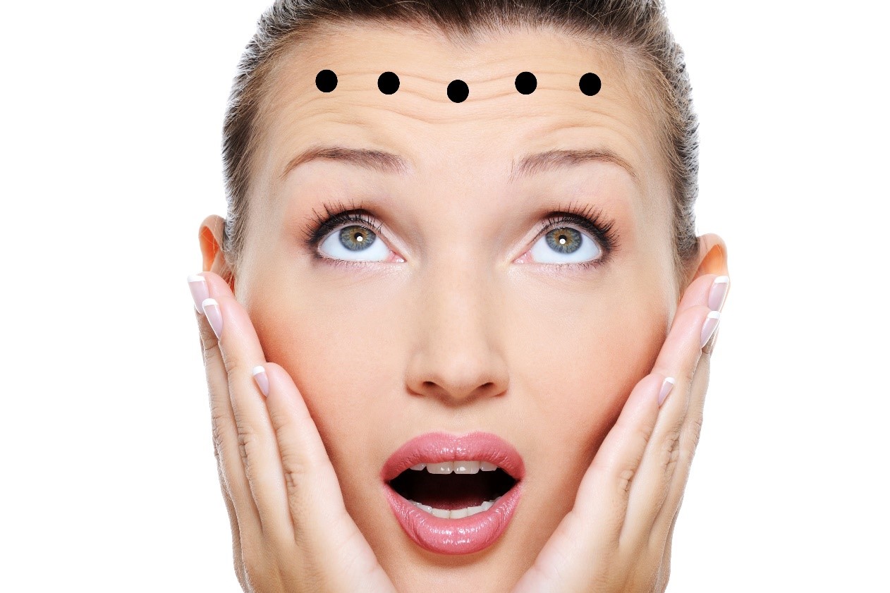 ¿COMO SABER SI UNA PERSONA LLEVA BOTOX?