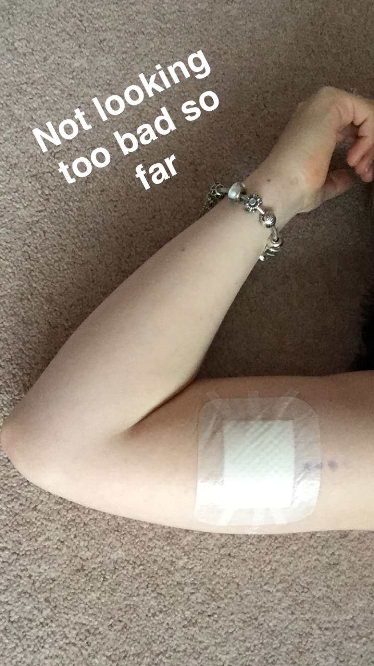 Tantrums, Tears, & No Tiaras: My nexplanon implant saga