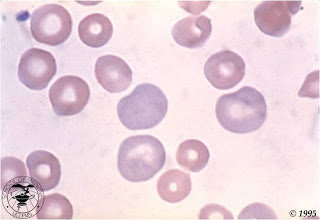 BIOMETRIA HEMATICA: Aprende Sobre Biometria Hematica