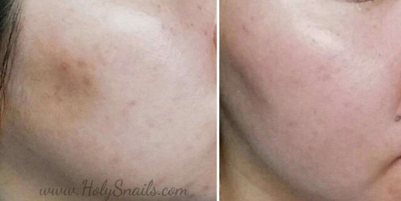 Hada Labo Shirojyun Arbutin Lotion Review Holy Snails