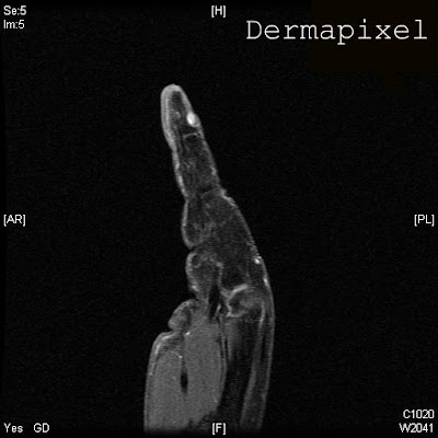 Dermapixel: octubre 2012