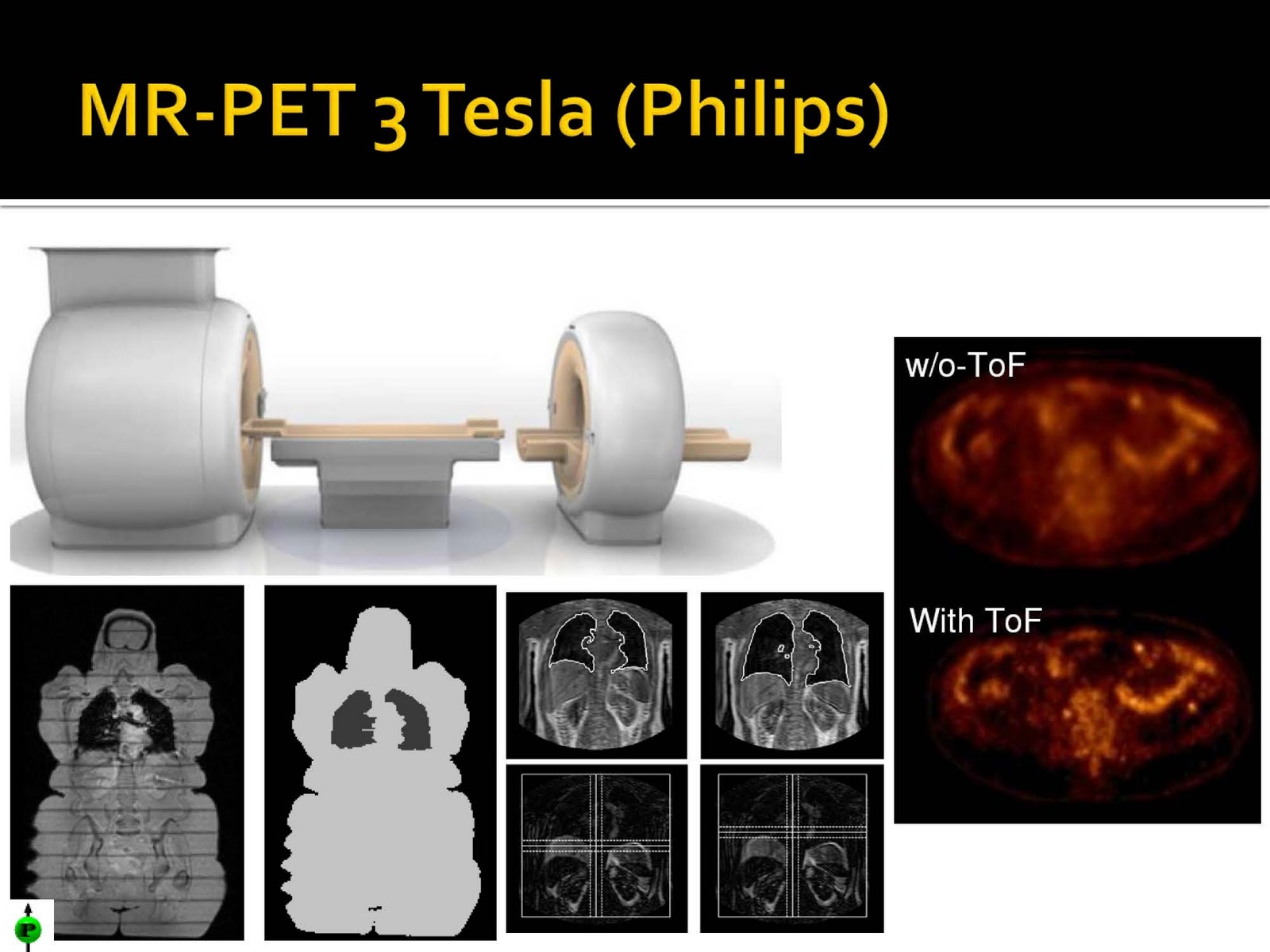 MRI and Medical Imaging: Μαγνητική τομογραφία στα 3 Tesla: εξελίξεις ...