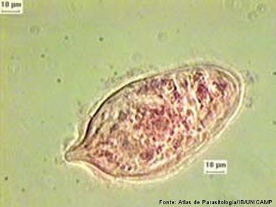 Schistosoma Mansoni e a Esquistossomose - Análises Clínicas.com