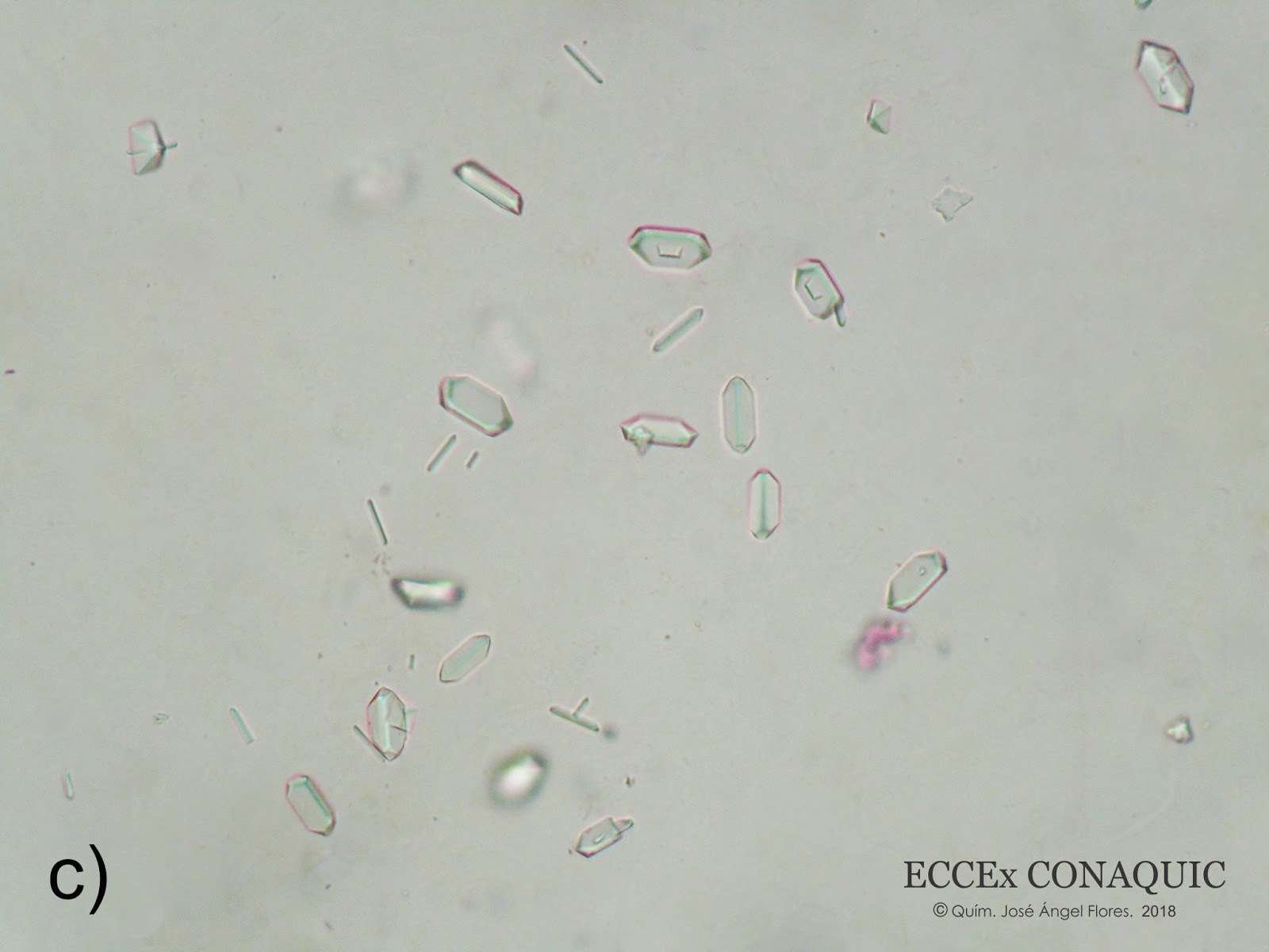 Caso UR-septiembre-18 (Enfoque: cristaluria)
