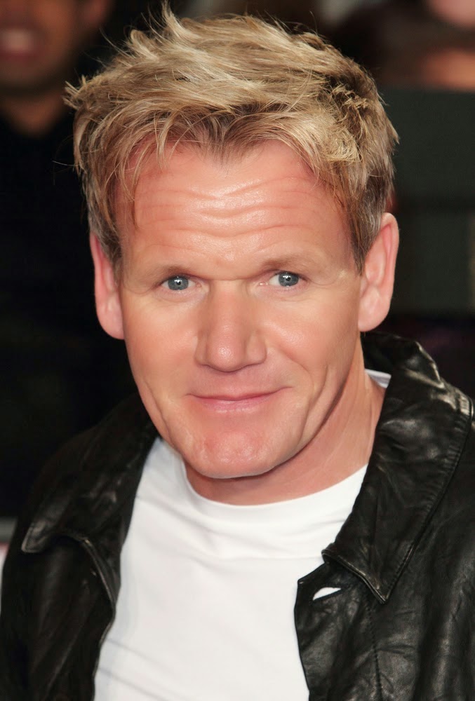 Celebrity Hair Loss: Transplant Watch: Gordon Ramsey