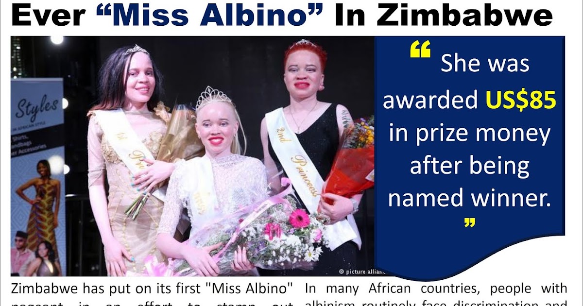 Edeson Online News: 22-Year-Old Sithembiso Wins First Ever “Miss Albino ...