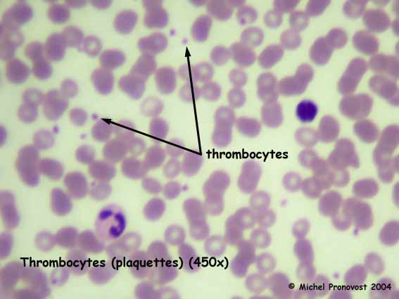 Trombosit (keping darah)