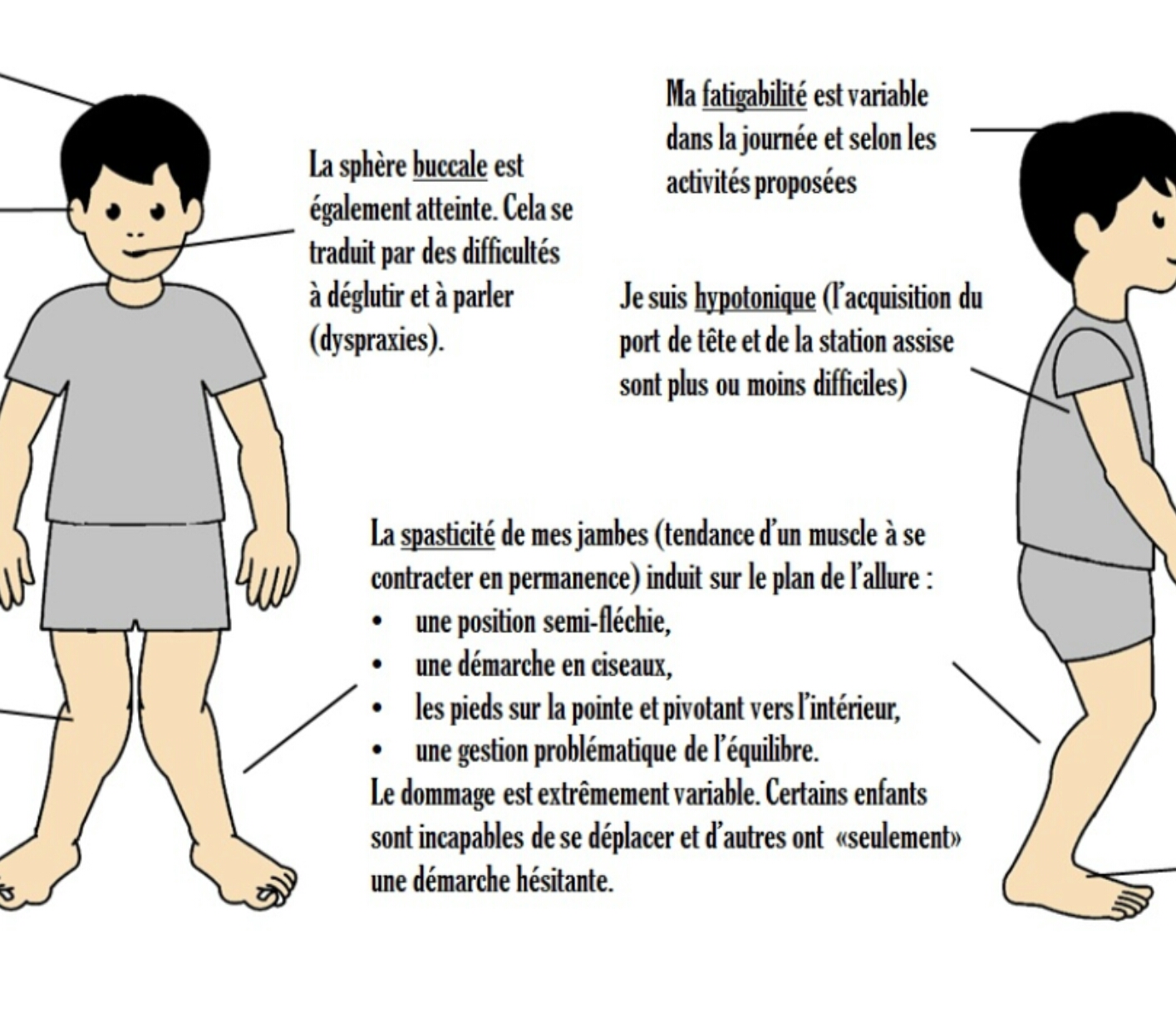 La Paralysie Cérébrale