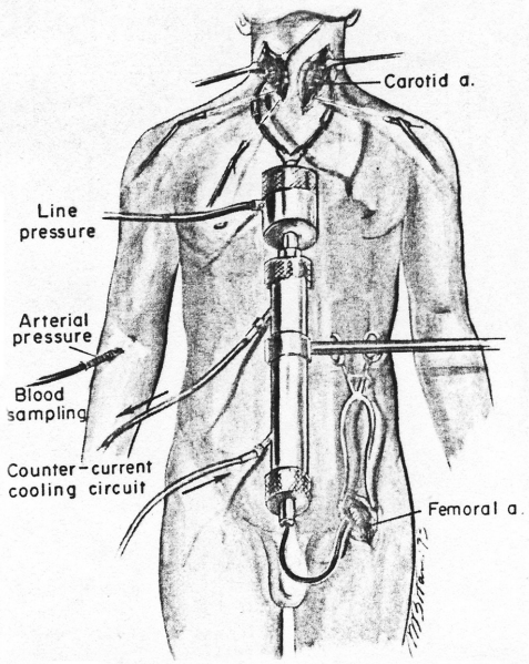 Health : HOW TO PERFORM A HEAD TRANSPLANT.