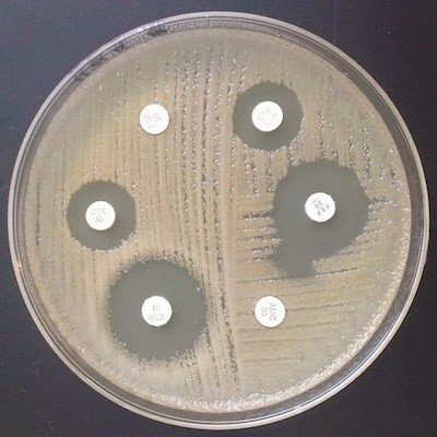 Microbiología: Antibiogramas