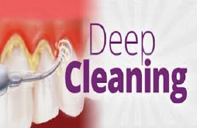 Removing Wisdom Teeth: Deep Cleaning