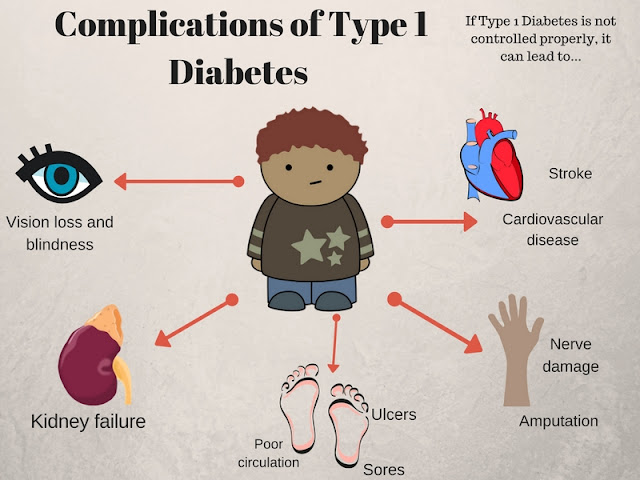 What is Type 1 diabetes? | DiabetesSecrets247