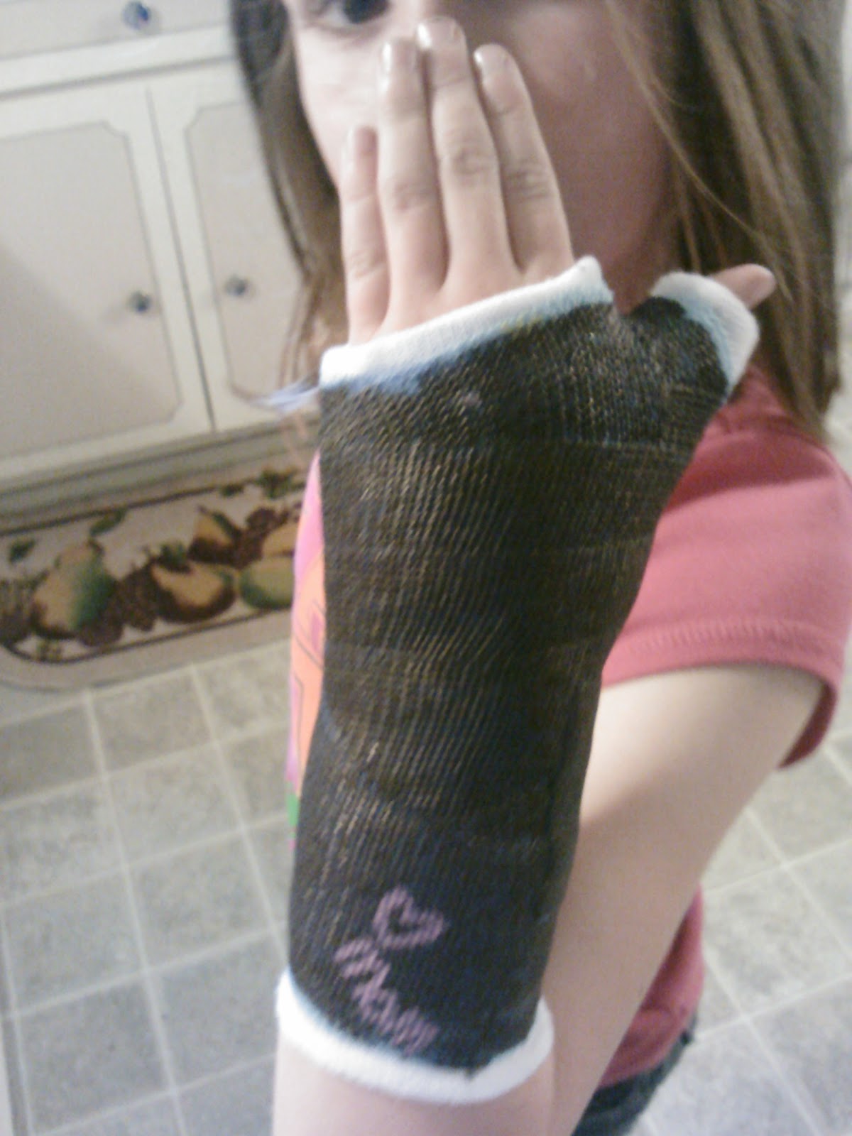 The Kindschi Family: Dariens first broken bone