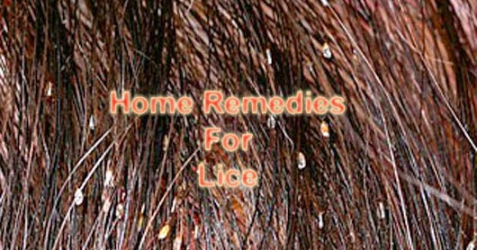Home Remedies For Lice [How to Get Rid] | Arbkan