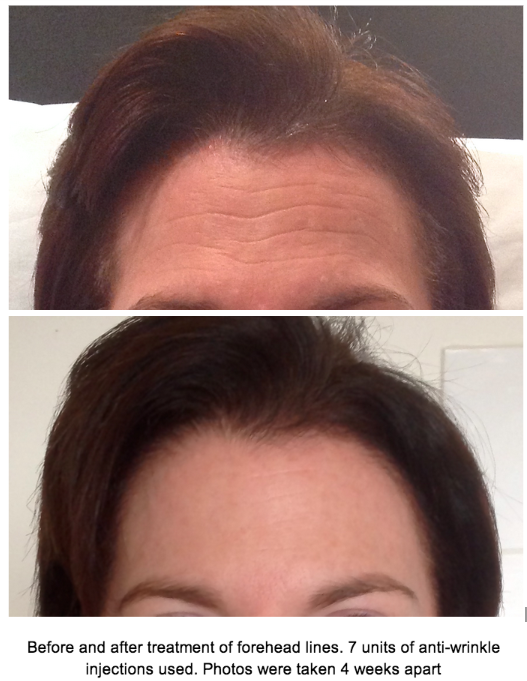 Cityskin cosmetic clinic in Melbourne. Visit www.cityskin.com.au to ...