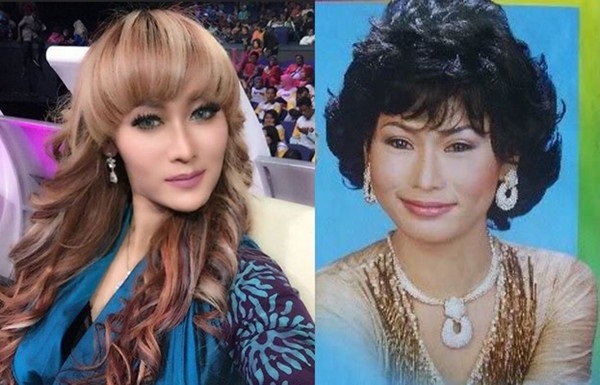 39+ Foto Artis Indonesia Yang Operasi Plastik