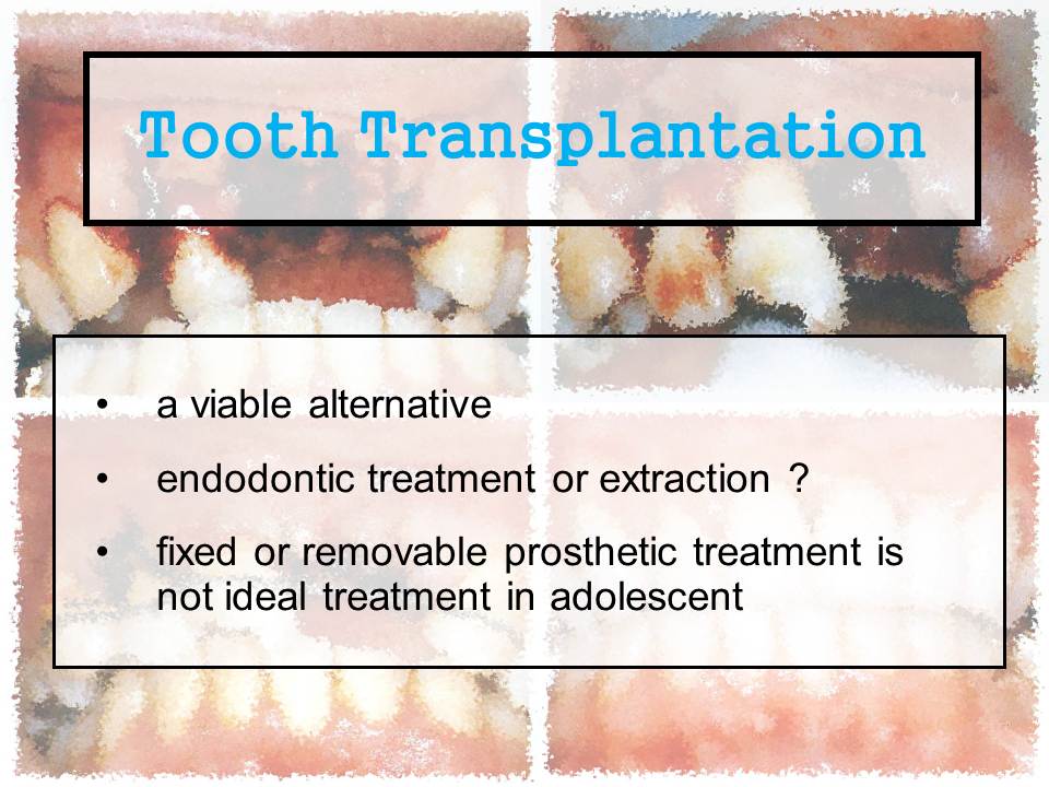Dentistry: Tooth Transplantation