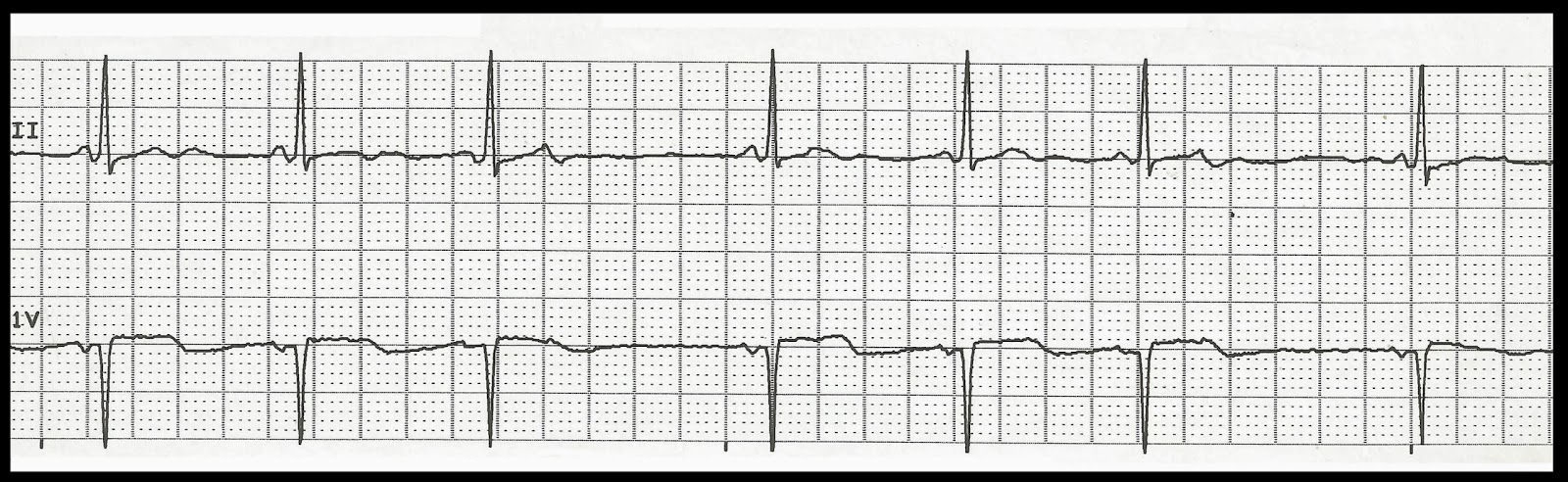 Practice EKG Rhythm Strips 209
