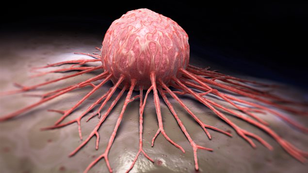 tumeur : Définition, type ~ ProBiologiste