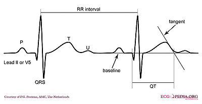 Cara Mengetahui dan Menghitung konduksi EKG