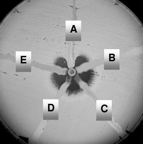Biomedicina Diagnóstica: KPC