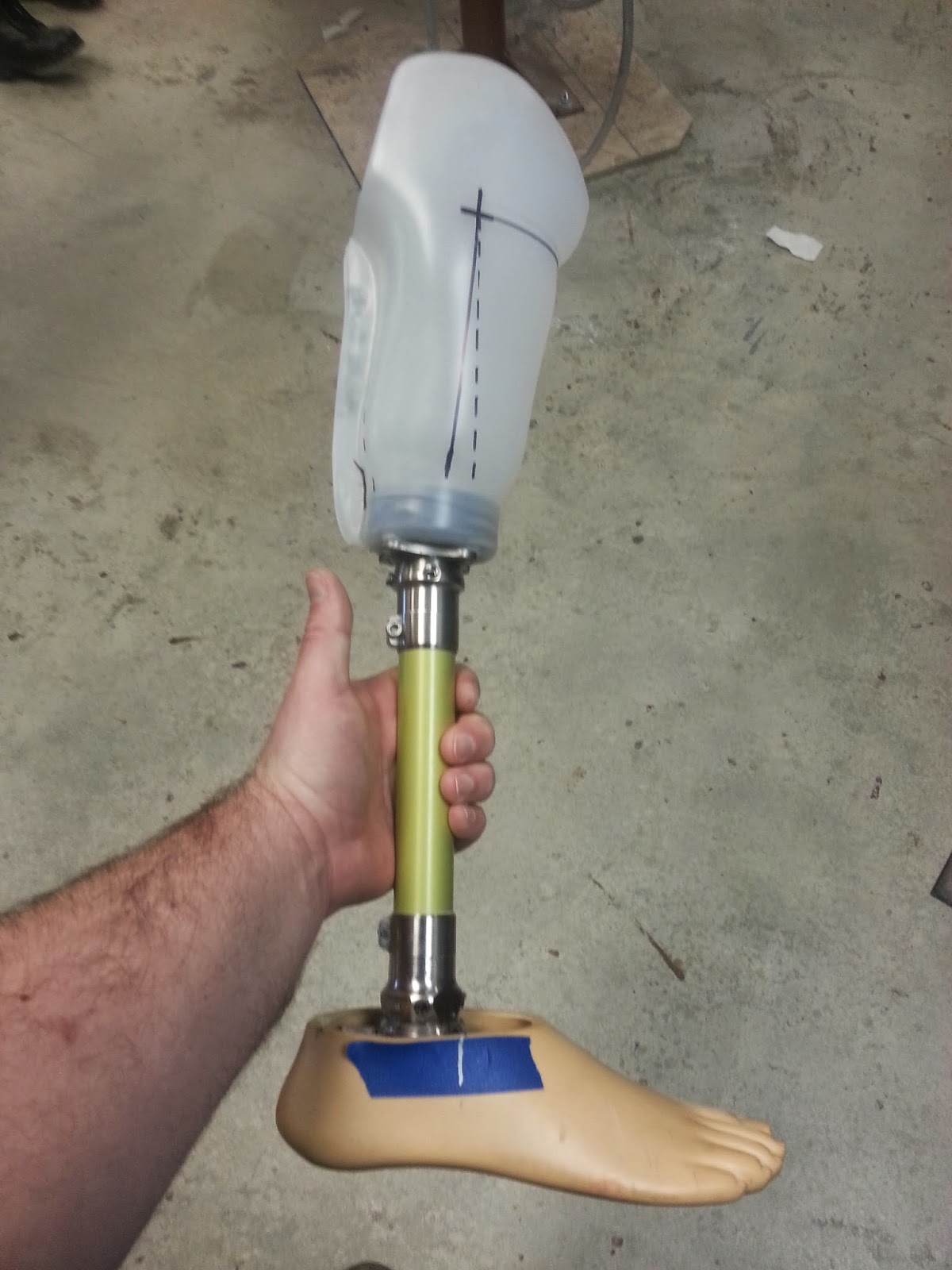 Prosthetic Projects: Locking liner Carbon Fiber transtibial ...