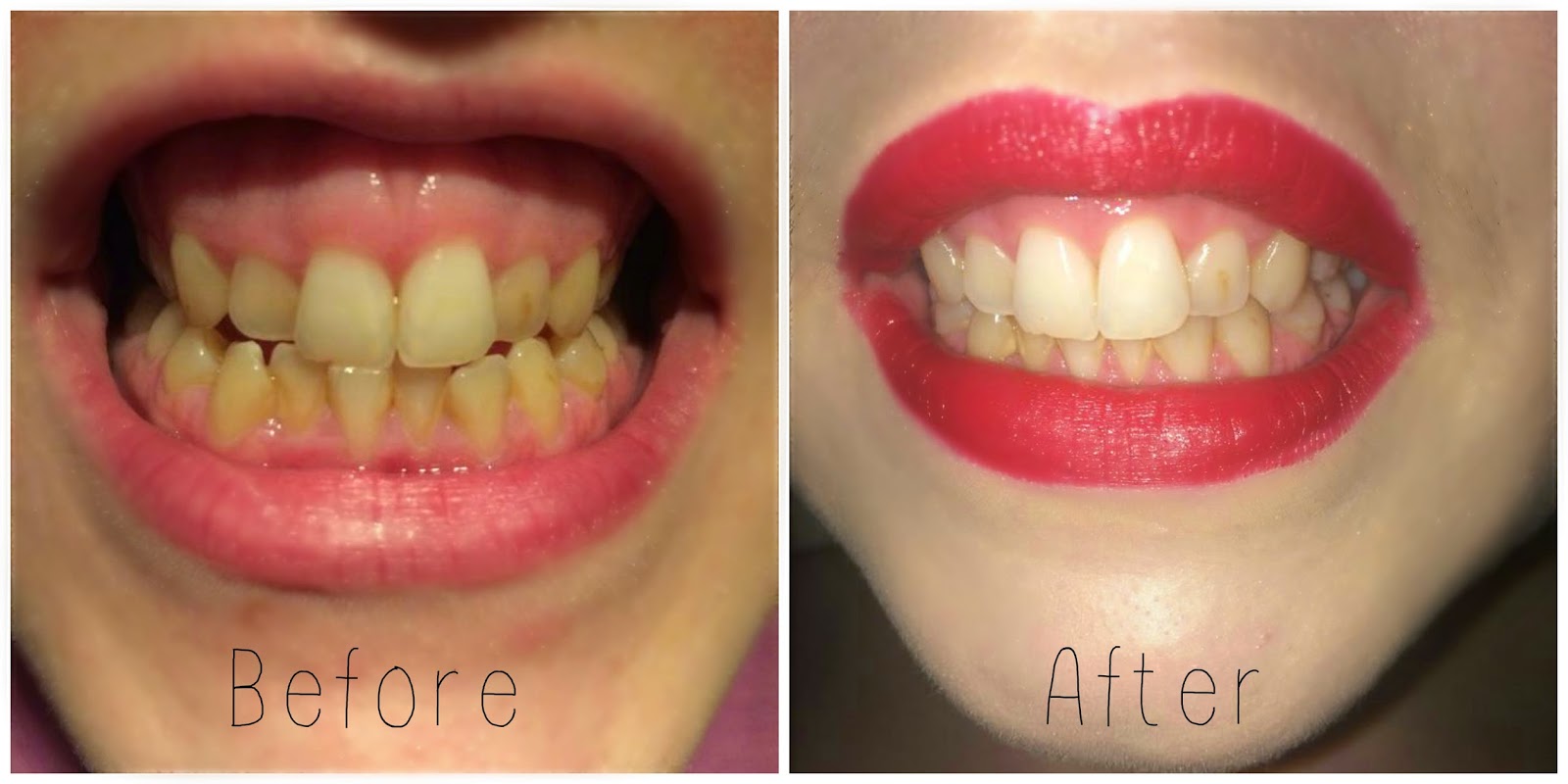 Style Addict: CocoWhite Teeth Whitening Review