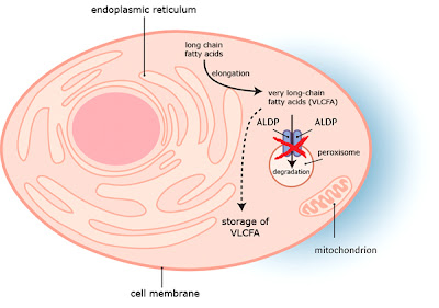 Adrenoleukodystrophy: Dietary Management