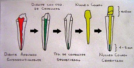 ESTOMATOLOGIA PASO A PASO PARA ESTUDIANTES: PLAN DE TRATAMIENTO DE ...