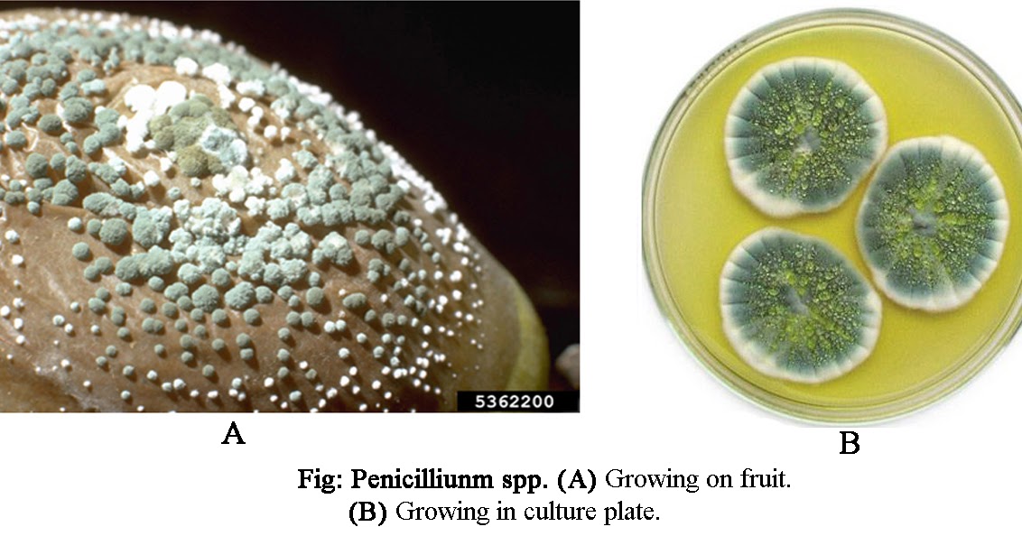 PENICILLIUM - CLASSIFICATION, VEGETATIVE STRUCTURE, REPRODUCTION ...