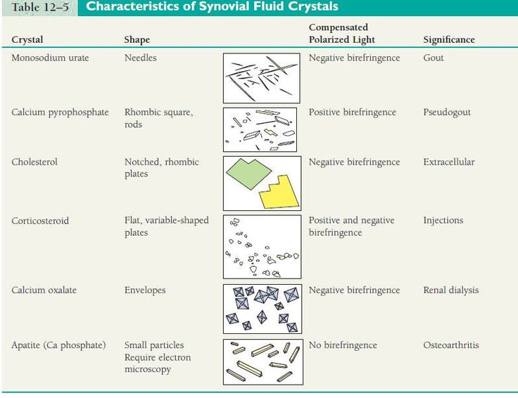 Medical Laboratory And Biomedical Science Quality Improvement In The Identification Of Crystals