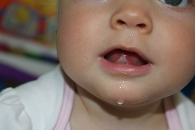 Beauty in the Ordinary: Tongue Trauma