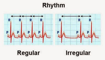 Cara Membaca EKG Dengan Benar dan Cepat From A to Z | INA - ECG