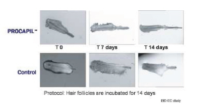 hair treatment pilose shampoo | tradekorea