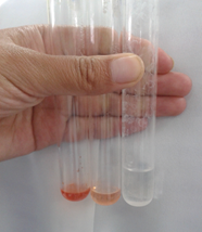 PRACTICAS DE BIOQUIMICA: REACTIVO DE FEHLING