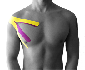 ARES Kinesiology Tape: Arestape Applications - Chest Pain 1