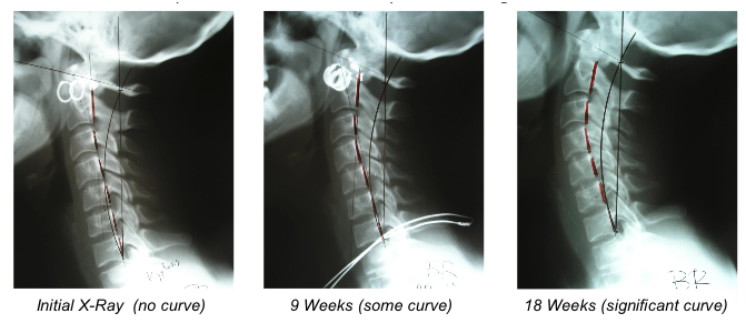 Institute for Functional Health : Maintaining a Healthy Neck for Life ...