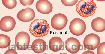 Absolute Eosinophil Youtube