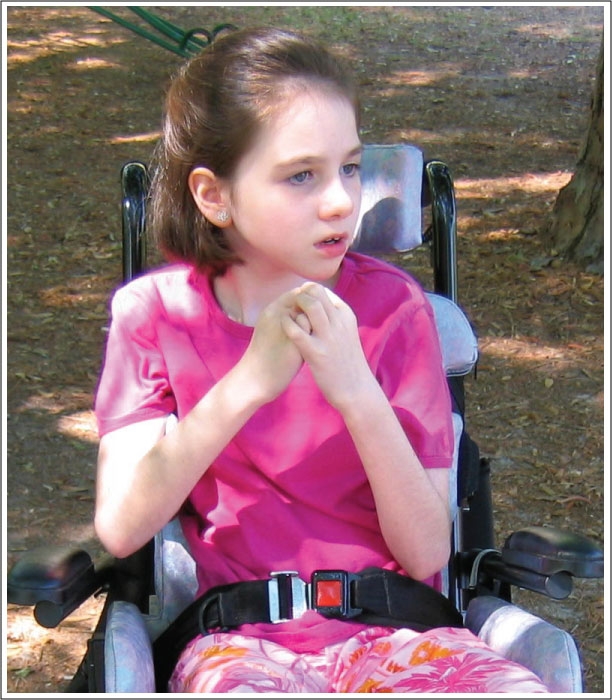 Amadurecendo Com Saúde: Crianças com Síndrome de Rett: Manifestações ...