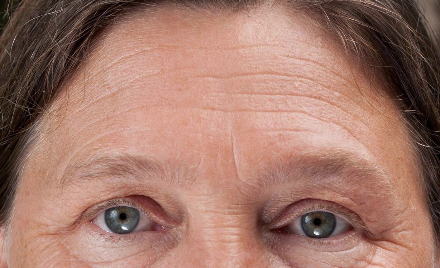 Strengthen Face Skin And Jowls Using Facial Aerobics: Ultimate Brow ...