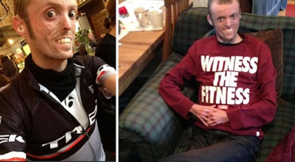 Tom Staniford, el hombre que ¡no puede engordar! : FULL-REVISTA