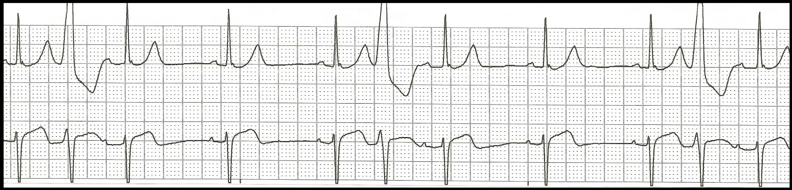 ECG Rhythm Strip Quiz 112