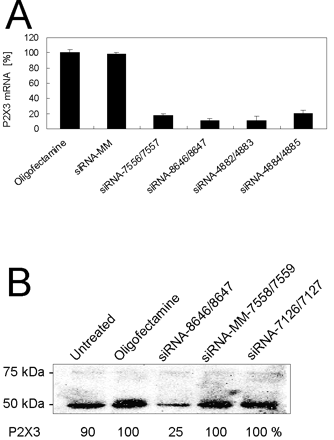 Neuromics: P2X3 Receptor and Inflammatory Nociception
